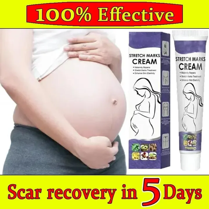 Stretch Mark Remover Permanent Stretch Mark Removerstretch marks remove ...