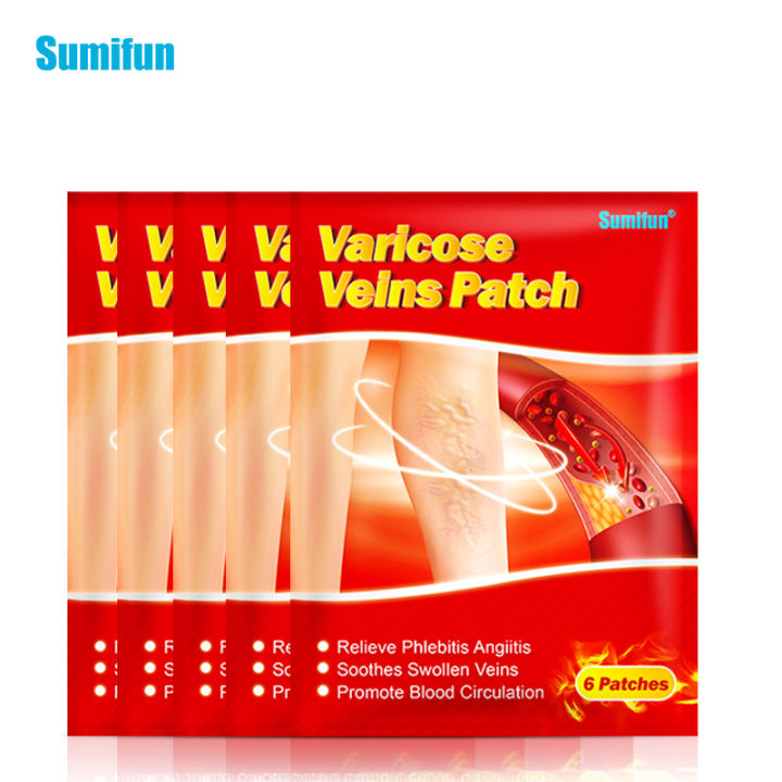 30/60Pcs Varicose Veins Plaster Chinese Medical Patch Vasculitis ...