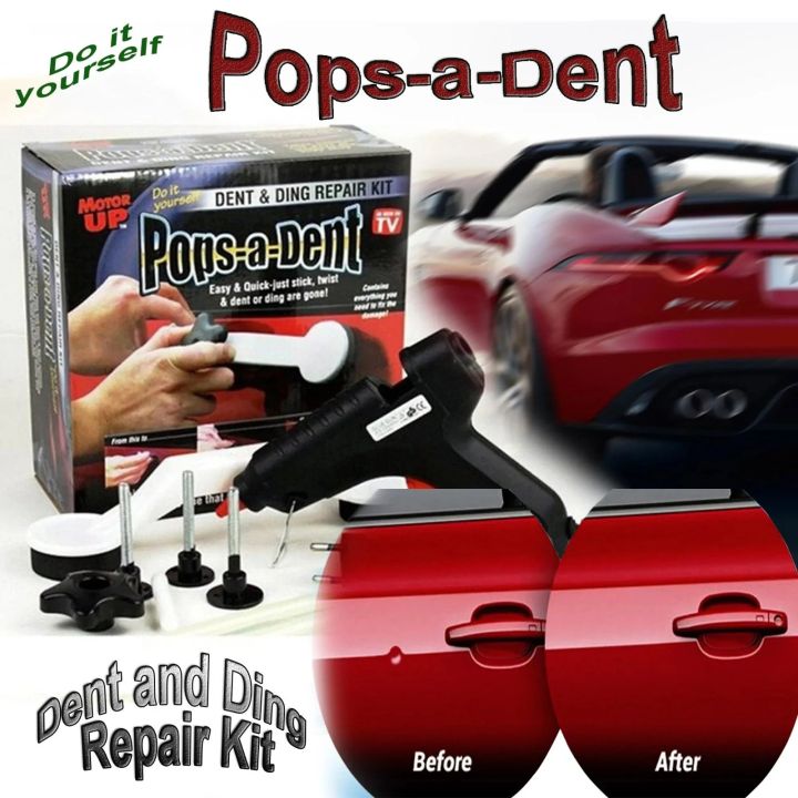 Pops a Dent Car Repair Kit Easy Quick Car Care Tools Set Kit for ...