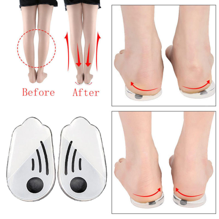 2Pcs Magnetic Silicone Insoles Orthopedic O/X-type Legs Corrector ...