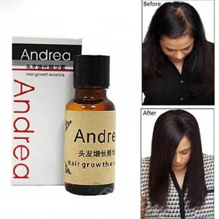 Andrea Hair Growth Essence Oil 20ml Ahgo Iquid Essence For Damaged Hair ...