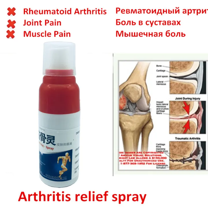 【TrendGlobe】relief pain spray analgesic spray Arthritis spray ...