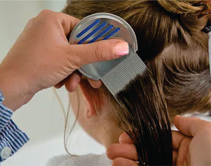 Lice Comb, Stainless steel handle lice comb | Daraz.lk