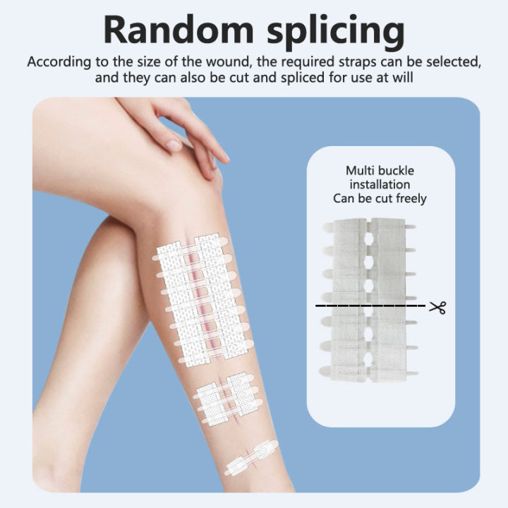 Zip Stitch Wound Bandages Emergency Wound Closures Adhesive Seamless ...