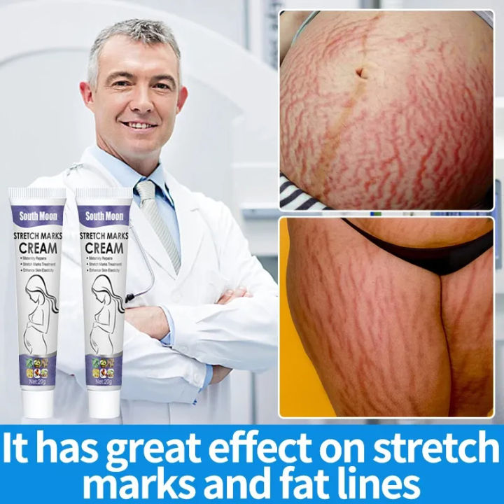 Stretch Marks Permanent Removal Cream Eliminate Body Belly Stretch ...