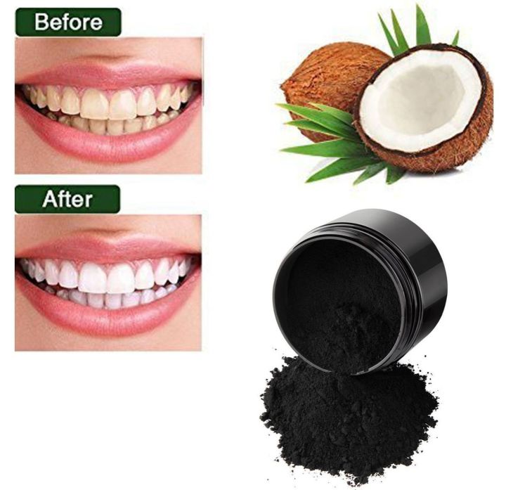 ONTEL Miracle Teeth Whittener (mtwp) Natural Whittening Coconut ...