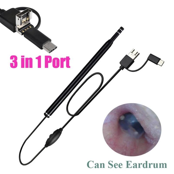 Medical USB Ear Cleaning Tool HD Visual Earwax Spoon Earpick Otoscope ...