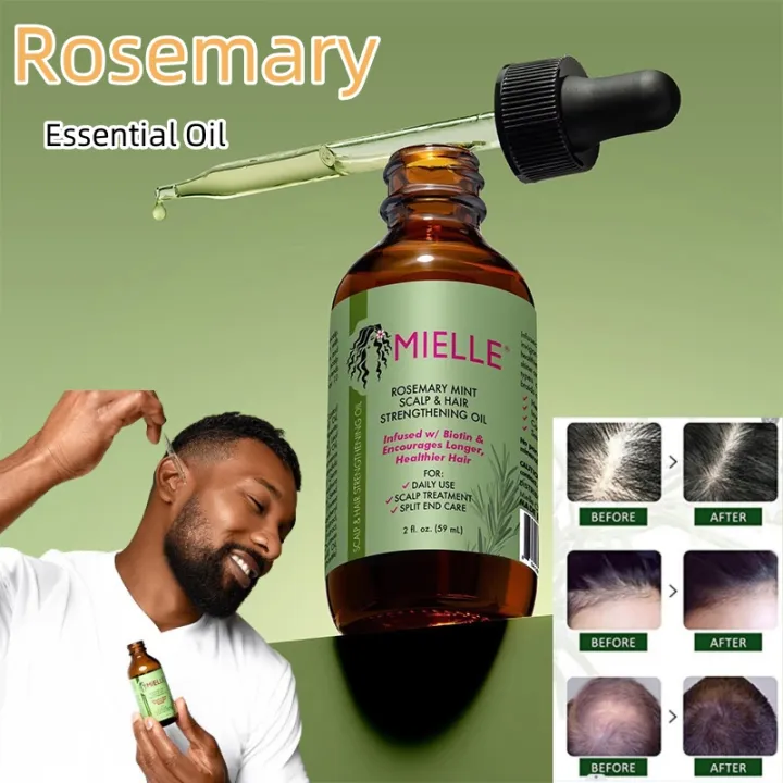 Mielle Rosemary Hair Growth Essential Oil Mint Nourishing Treatment for ...