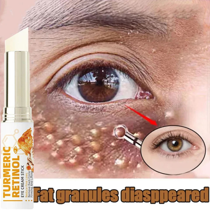 Eye Cream Fat Granules Removal Anti-Puffiness Firming Cream Anti ...