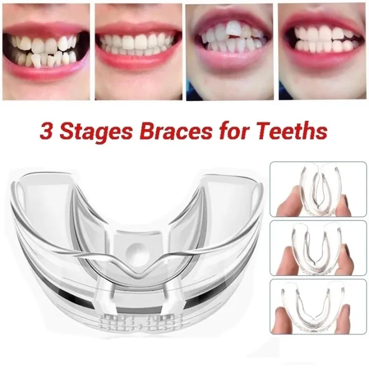 Dental Orthodontic Teeth Corrector Braces Retainer Straighten Tools ...