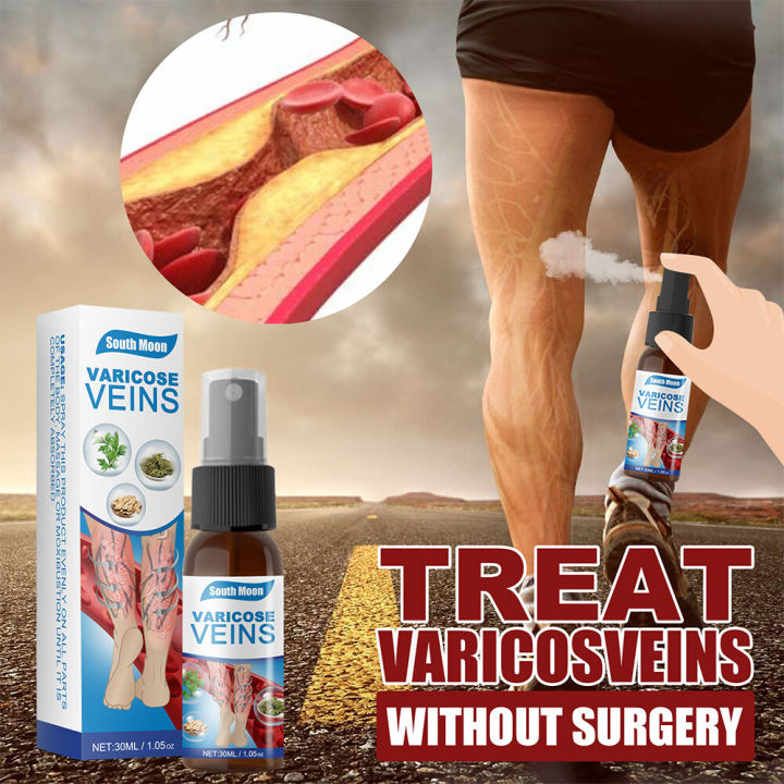 Varicose Vein Spray Smoothes Legs Blood Vessel Bulges Phlebitis Spider ...