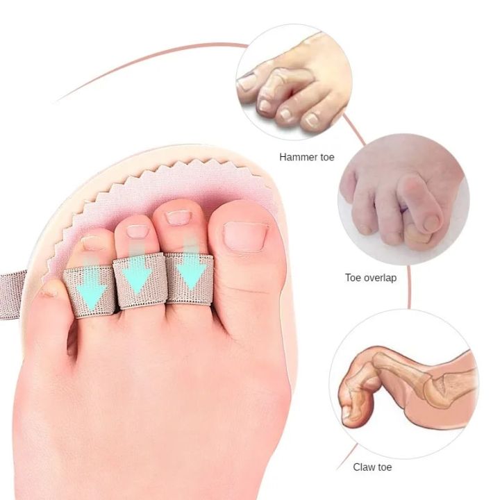 1pcs Hammer Toe Straightener Bunion Corrector Adjuster Hallux Valgus ...