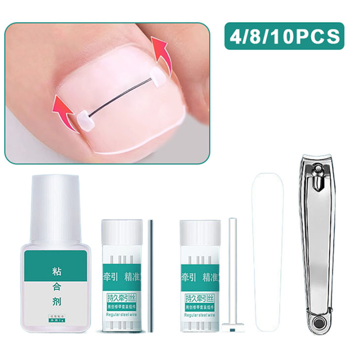 Ingrown Toenail Corrector Tools Pedicure Recover Embed Toe Nail ...