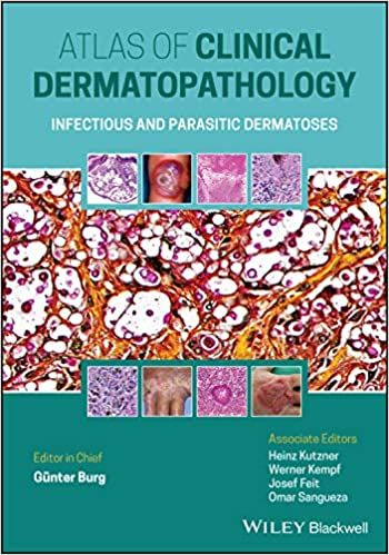 Atlas of Clinical Dermatopathology: Infectious and Parasitic Dermatoses ...