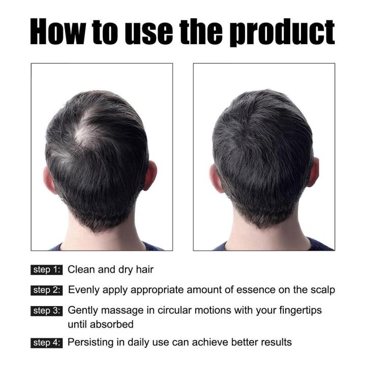 Hair Essence Oil Hair Anti-Loss Treatment Nutrients Thick Oil For Men ...