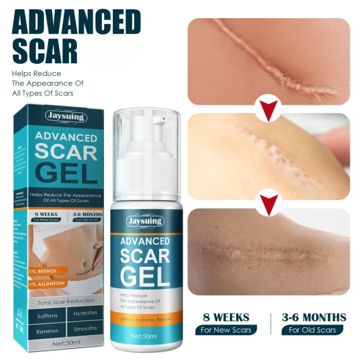 Scar Removal Cream Repaire Pock Mark Burn Surgical Scars Acne Pox ...