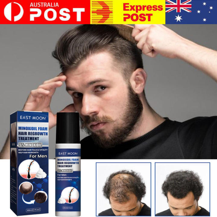 【User-friendly】 Minoxidil Hair Regrowth Foam Treatment for Men Hair ...