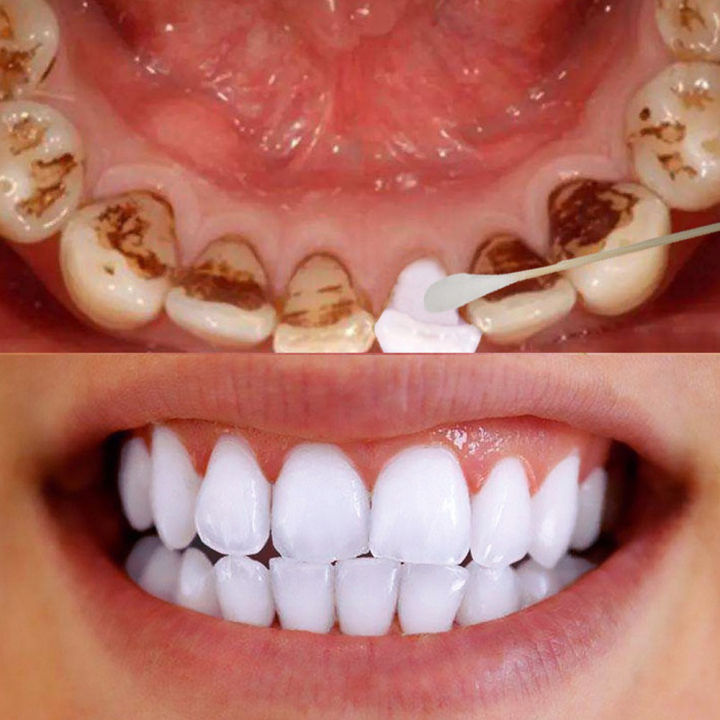 【Unique features】1pc powder paste Teeth Care Remove Halitosis Plaque ...