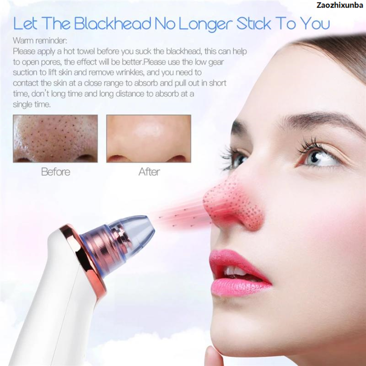 ZaozhixunbaOriginal USB Electric Blackhead Remover Vacuum Facial Acne ...