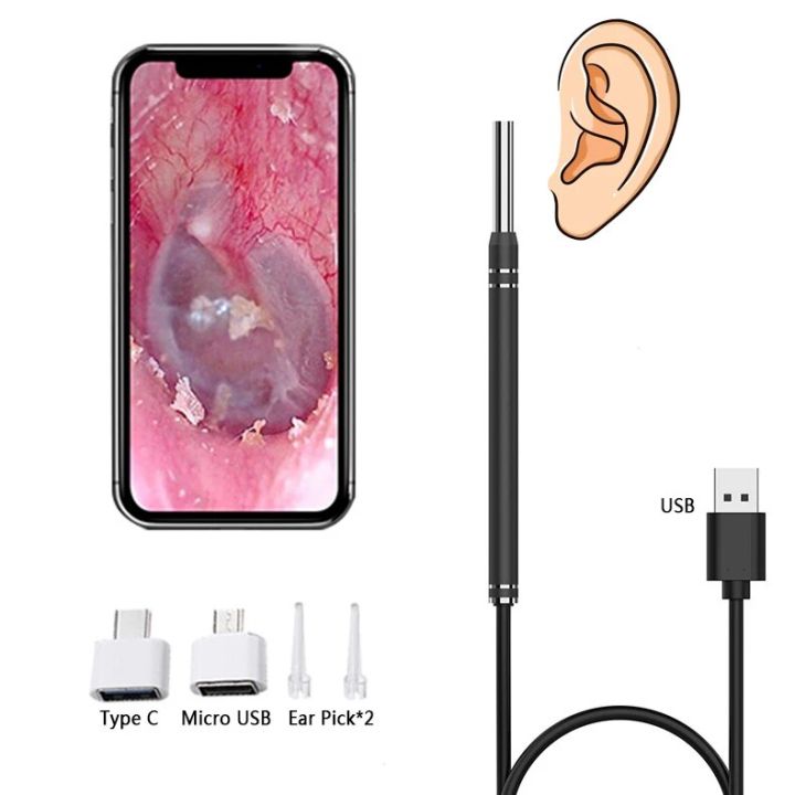 Intelligent visual earwax cleaner, ear stick, ear removal camera ...