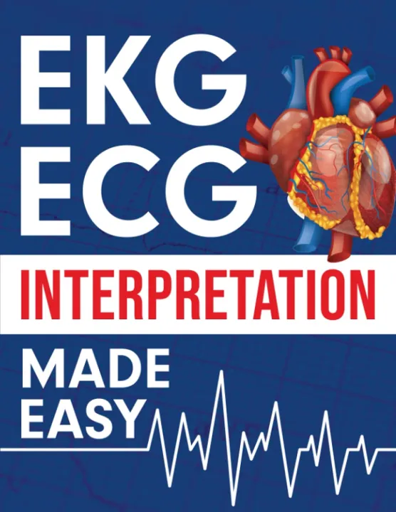 EKG | ECG Interpretation Made Easy: An Illustrated Study Guide For ...