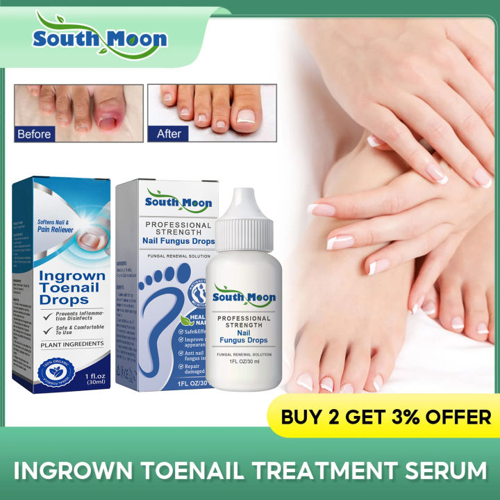 Ingrown Toenail Treatment Serum Paronychia Nail Softener Correction ...