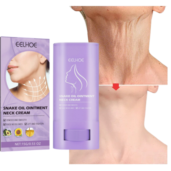 Neck Lines Cream Moisturis Lift Neck Eliminate Double Chin Eliminate ...
