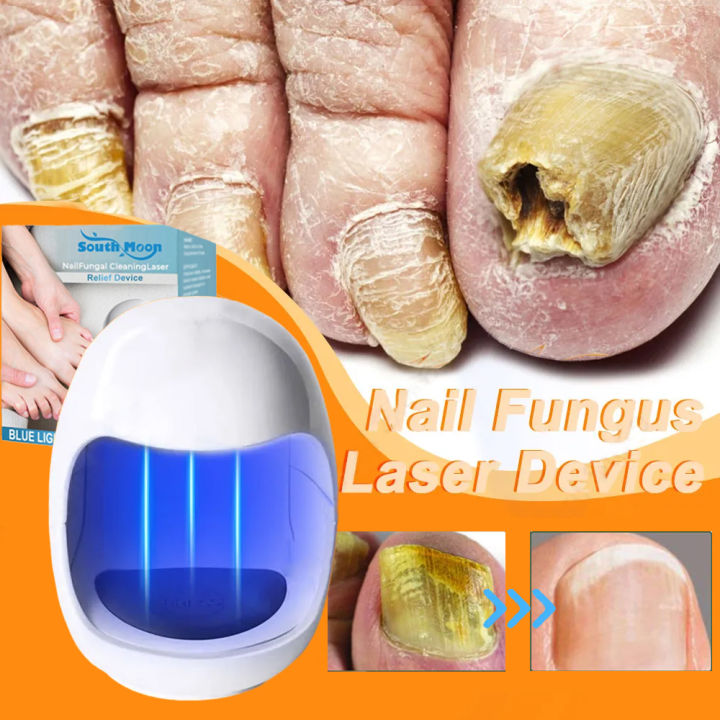 Laser Nail Fungus Treatment Device Repair Ingrown Toenail Fingernail ...