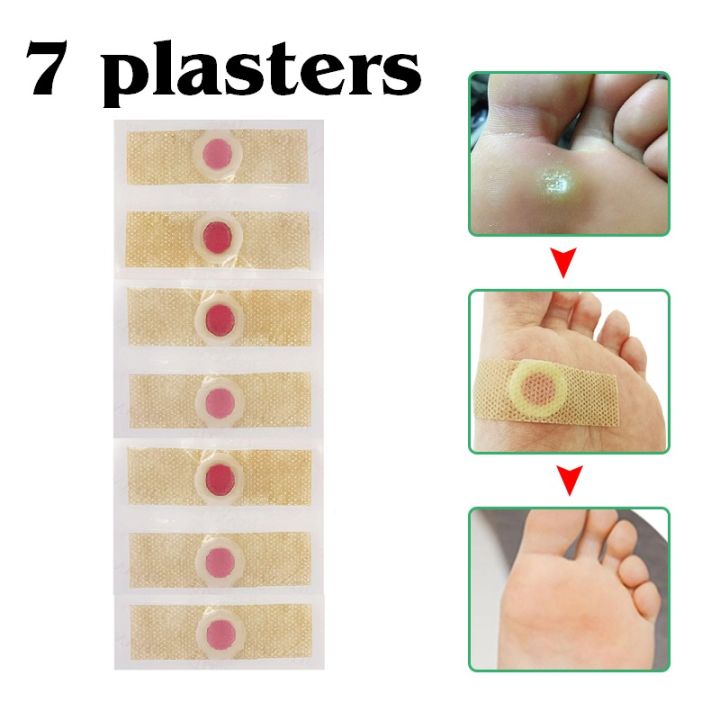warts removal Corn Plaster for 14 days easy wart removal without any ...