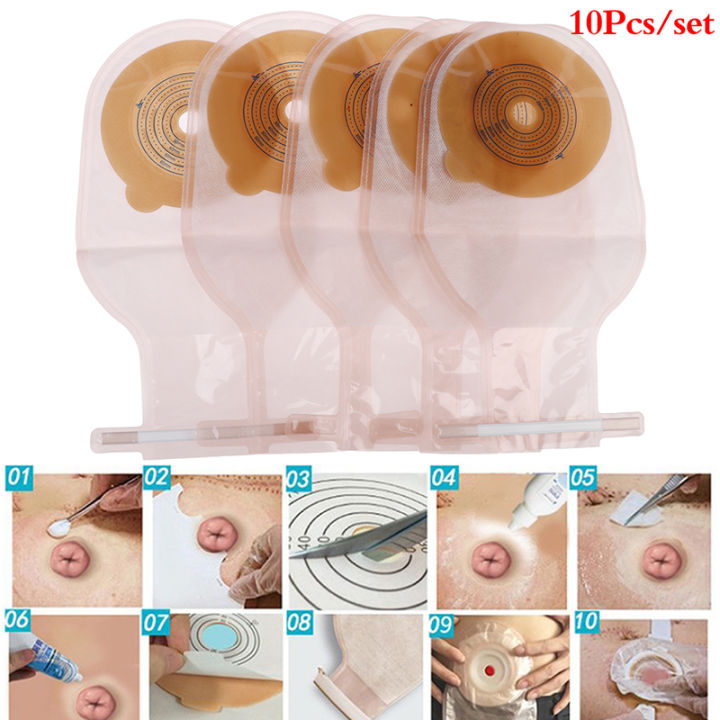 【Buy with eyes closed】Colostomy Bags Max Stoma 60mm Skin Color Ostomy ...