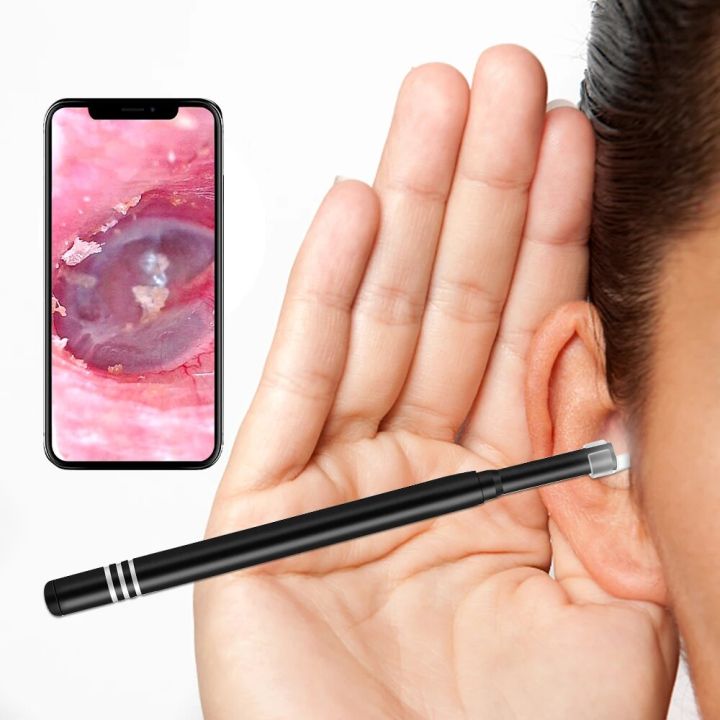 Visual Ear Pick Ear Cleaner Wax Removal Endoscope Camera Otoscope with ...