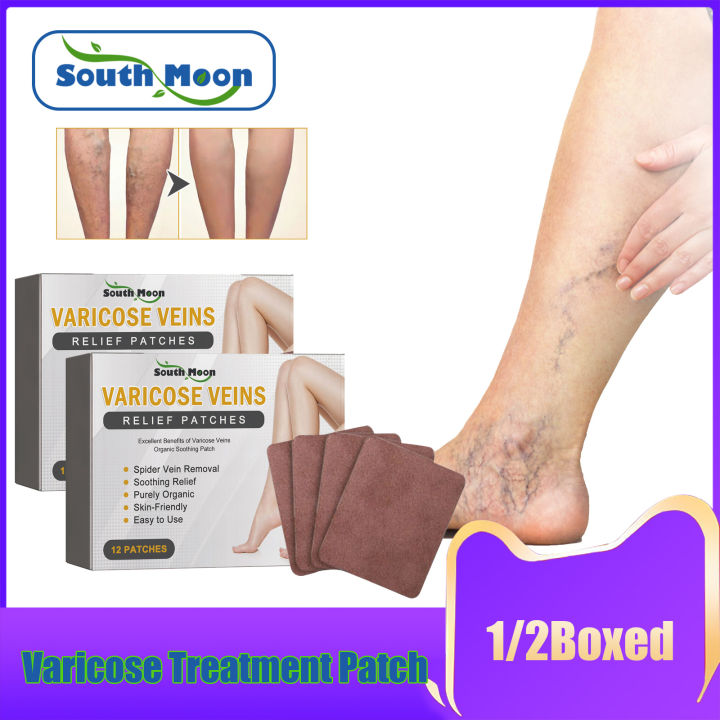 Varicose Vein Removal Patch Effectively Relieve Spider Leg Vasculitis ...