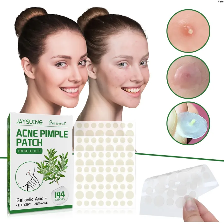 YekeSpecial 144 Patches Acne Pimple Patch Face Invisible Stickers Quick ...