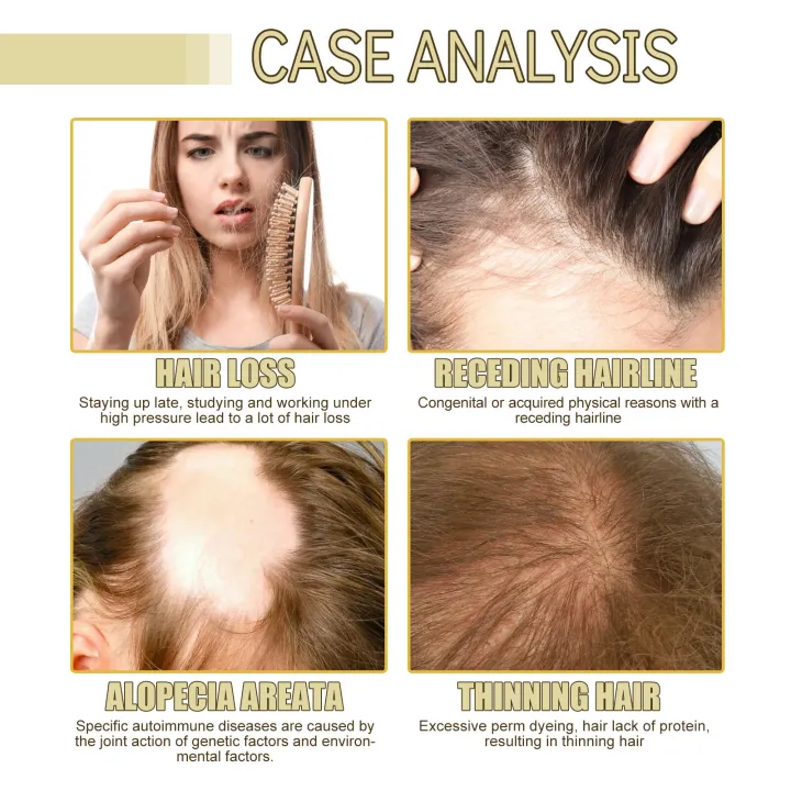 EELHOE Premium Hair Treatment Oil - Keratin & Protein Enriched, Paraben ...