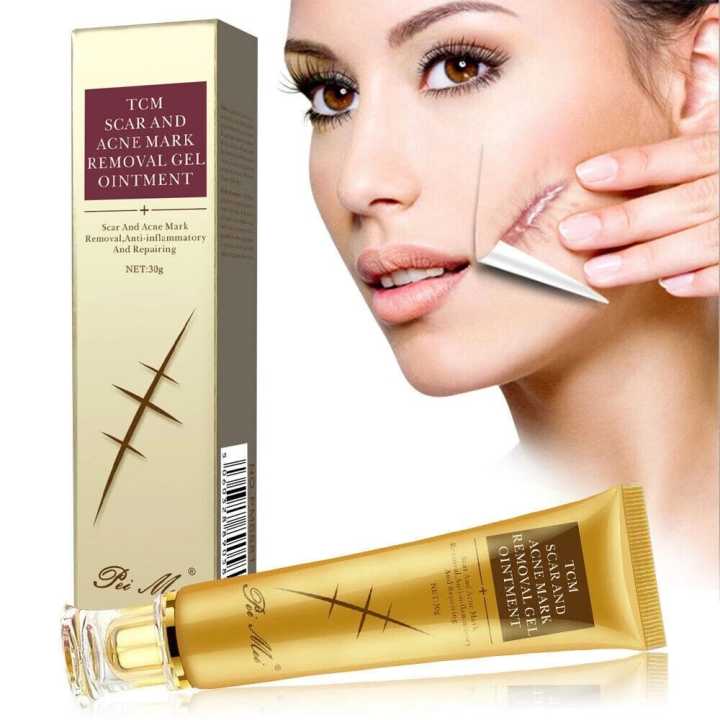 Original Tcm Scar and Acne Mark Removal Gel Stretch Marks/acne/scald ...