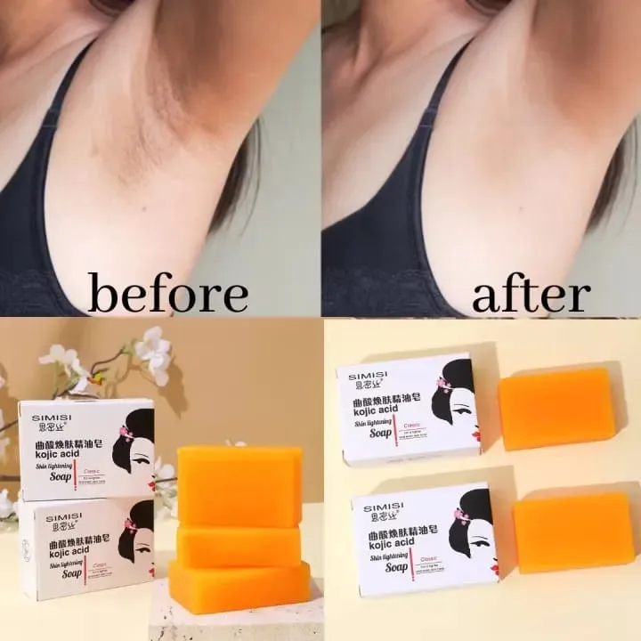 1 Piece Simisi Kojic Acid Soap – 80 g | Skin Lightening & Moisturizing ...