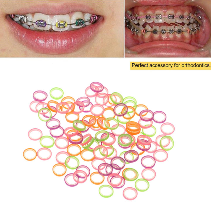 100Pcs Elastic Rubber Teeth Traction Rings Orthodontics Rubber Band ...