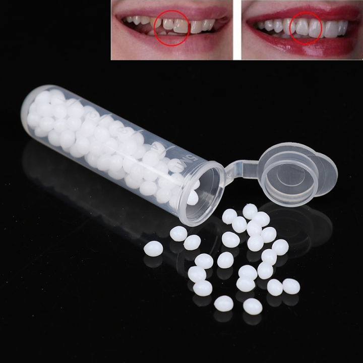 Temporary Tooth Repair Kit Teeth And Gaps False Teeth Solid Glue ...