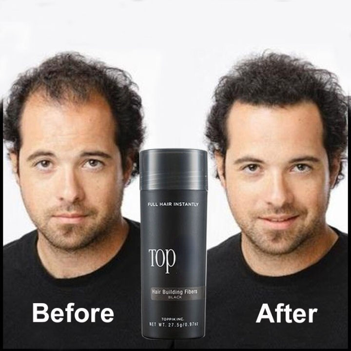 Hair Fibers Regrowth Powders Keratin Applicator Hair Building Fibers ...