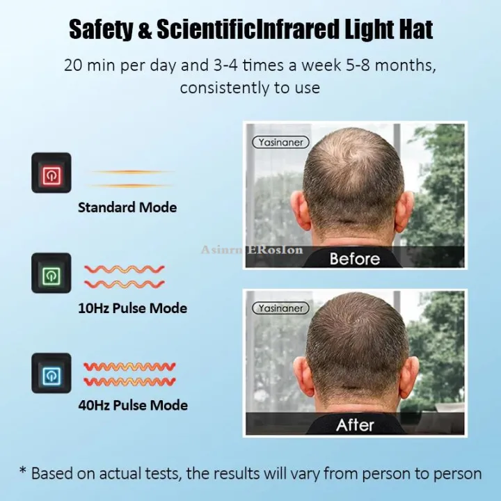 Asinrn ERosIon Red Light Therapy Cap Device Near Infrared LED Helmet ...