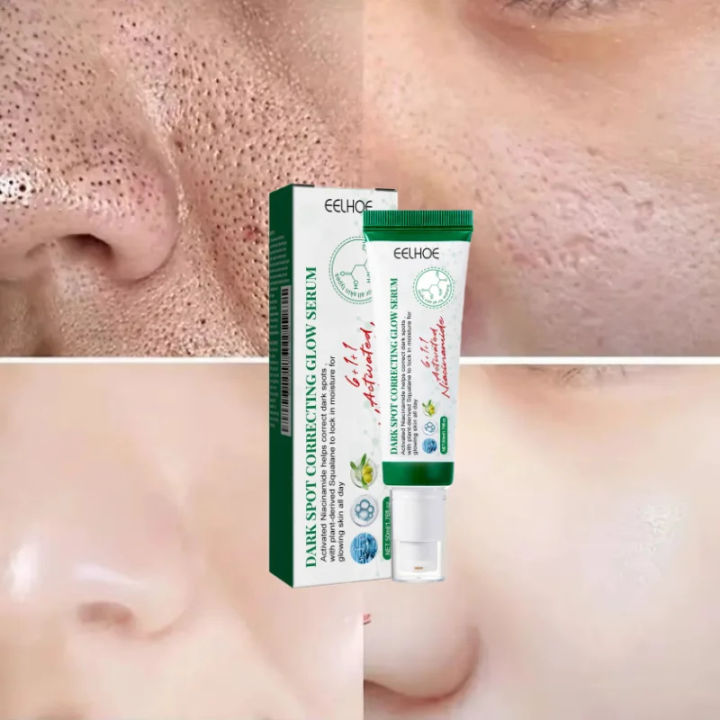 New style Pore Anti-Inflammatory, Smoothing, Acne Removal Pore ...