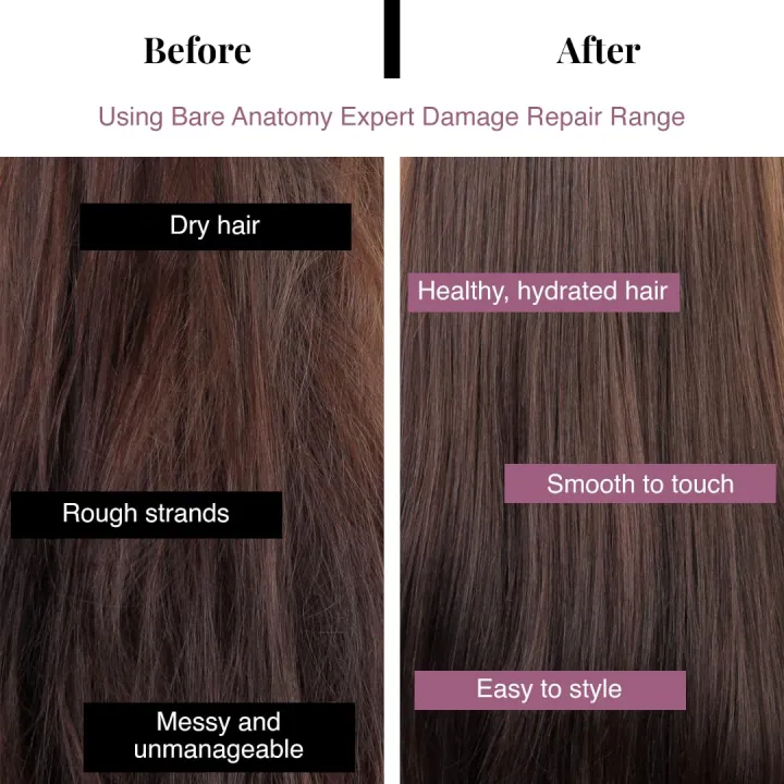 Bar Anatomy Ultra Smoothing Shampoo for Dry and Frizzy Hair | Restores ...