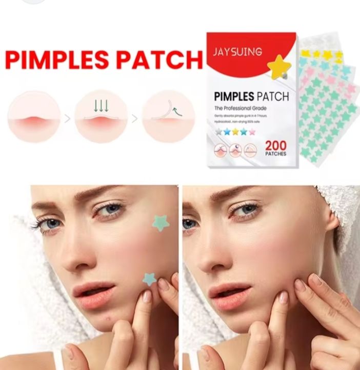 Professional Grade Pimples Patches For Acne Clear Skin- 200 Patches ...