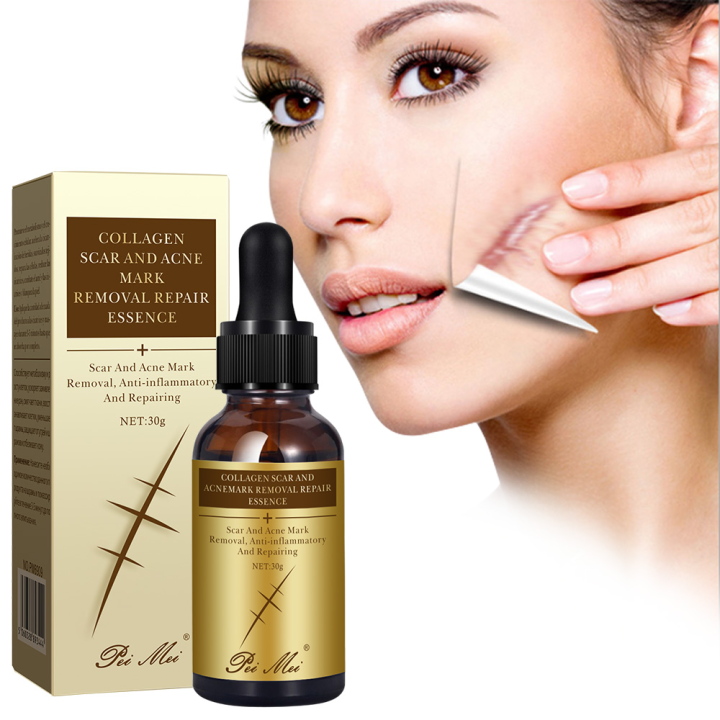 Pei Mei Dark Spot Removal Face Serum 30g | Collagen Scar & Acne Mark ...
