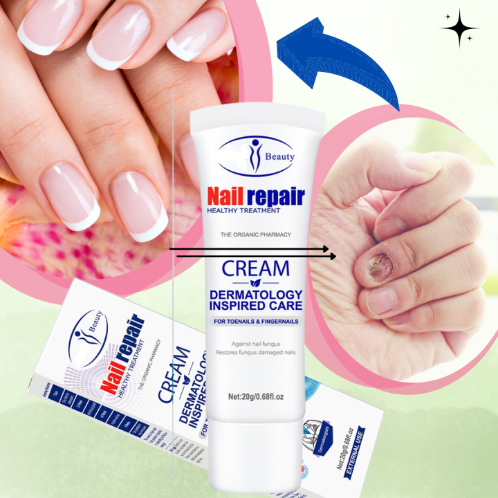 Aichun Beauty Nail Repair Cream Toenails Fingernails Care Anti Fungus ...