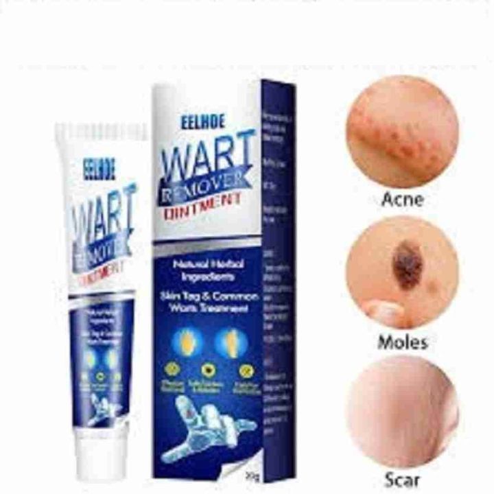 Wart Remover Cream (20g) | Daraz.com.np