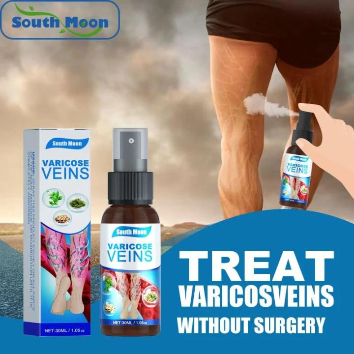 Spray for varicose veins Effective varicose vein relief cream to ...
