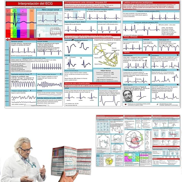 High Quality DIY EKG Pocket Guide Cardiac Rhythm Interpretation Made ...