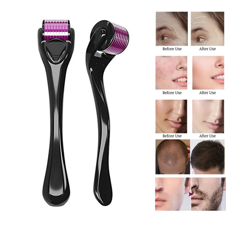 GlowNeedle Titanium Roller – Microneedling for Radiance & Regrowth ...
