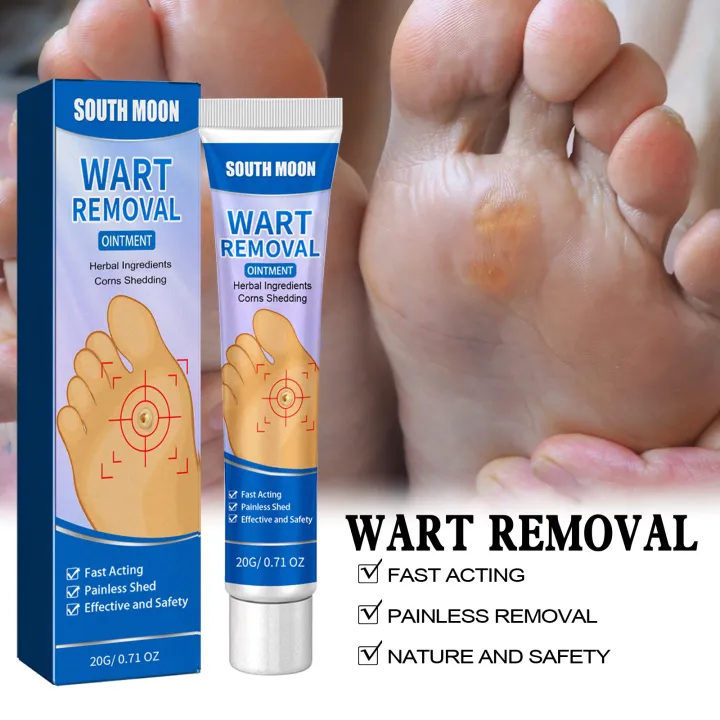 South Moon Warts Corn Cream Gentle skin repair, smooth body skin ...